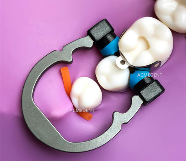 Dental Matrix Bands Ring Sectional Matrice Clamp Fit Garrison Palodent ...